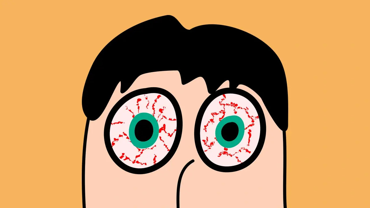 Comprehensive Guide of Understanding and Preventing Eye Strain – Arzopa